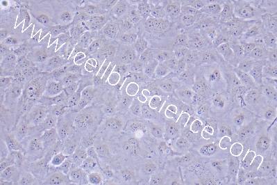 SRA01/04 人晶体上皮细胞-原代细胞-STR细胞-细胞培养基-镜像绮点生物