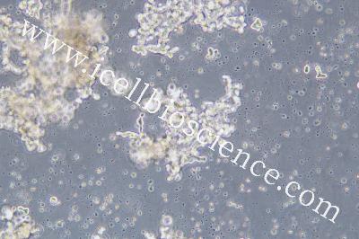 DU4475 人乳腺上皮细胞-原代细胞-STR细胞-细胞培养基-镜像绮点生物