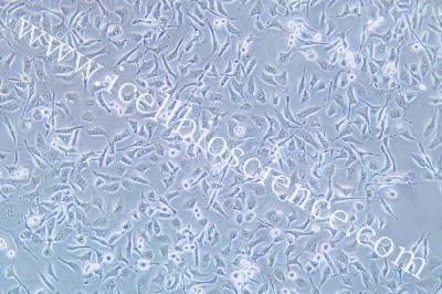 HNE1 人鼻咽癌细胞-原代细胞-STR细胞-细胞培养基-镜像绮点生物