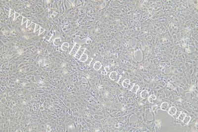 4T1+GFP 小鼠乳腺癌细胞绿色荧光标记-原代细胞-STR细胞-细胞培养基-镜像绮点生物