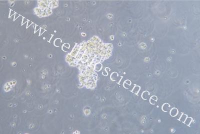 NCI-H69 人小细胞肺癌细胞-原代细胞-STR细胞-细胞培养基-镜像绮点生物