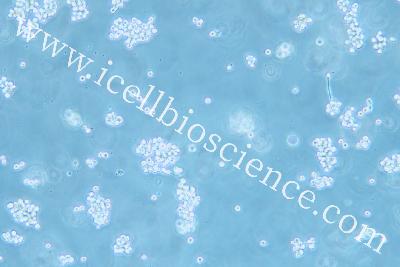 SNU-16 人胃癌细胞-原代细胞-STR细胞-细胞培养基-镜像绮点生物