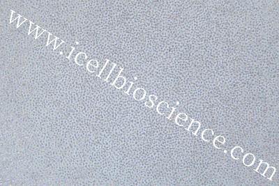 OCI-LY10 人弥漫大B淋巴瘤细胞-原代细胞-STR细胞-细胞培养基-镜像绮点生物