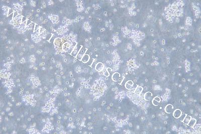 U2932 人B细胞淋巴瘤细胞-原代细胞-STR细胞-细胞培养基-镜像绮点生物