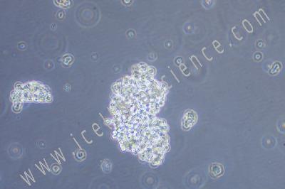 NCI-H660 人神经内分泌前列腺癌细胞-原代细胞-STR细胞-细胞培养基-镜像绮点生物