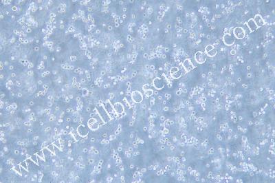 Pfeiffer 人弥漫大B细胞淋巴瘤细胞-原代细胞-STR细胞-细胞培养基-镜像绮点生物