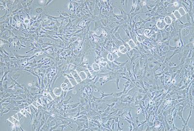 12Z 人子宫内膜异位细胞-原代细胞-STR细胞-细胞培养基-镜像绮点生物