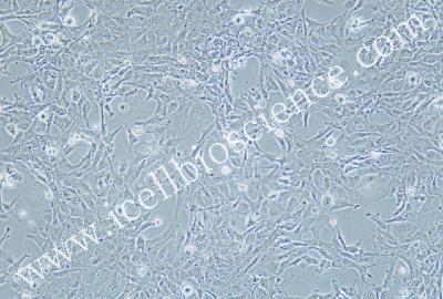 12Z 人子宫内膜异位细胞-原代细胞-STR细胞-细胞培养基-镜像绮点生物