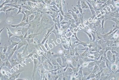 12Z 人子宫内膜异位细胞-原代细胞-STR细胞-细胞培养基-镜像绮点生物