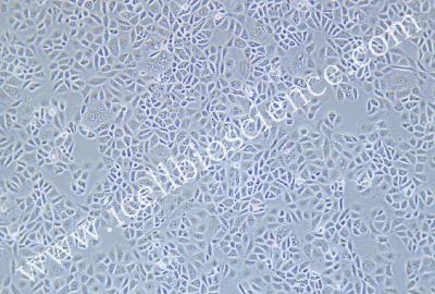 CAL-51 人乳腺癌细胞-原代细胞-STR细胞-细胞培养基-镜像绮点生物