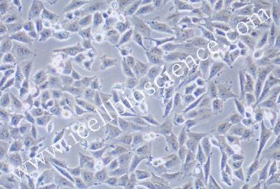 LN-18 人脑胶质母细胞瘤细胞-原代细胞-STR细胞-细胞培养基-镜像绮点生物