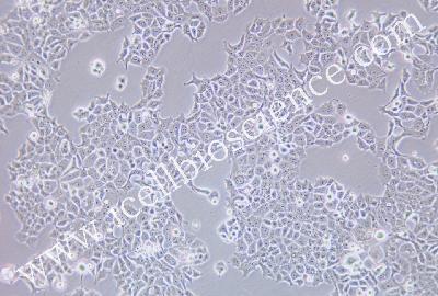NCI-H322 人非小细胞癌细胞-原代细胞-STR细胞-细胞培养基-镜像绮点生物