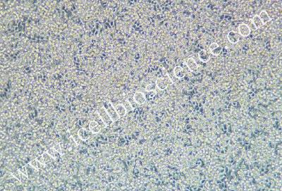 NCI-H2122 人非小细胞肺癌细胞-原代细胞-STR细胞-细胞培养基-镜像绮点生物