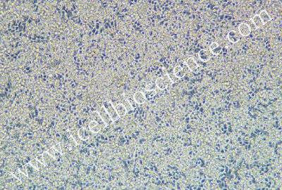 NCI-H2122 人非小细胞肺癌细胞-原代细胞-STR细胞-细胞培养基-镜像绮点生物