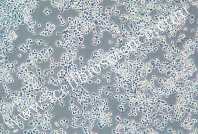 neuro-2a（N2A）小鼠脑神经瘤细胞-原代细胞-STR细胞-细胞培养基-镜像绮点生物